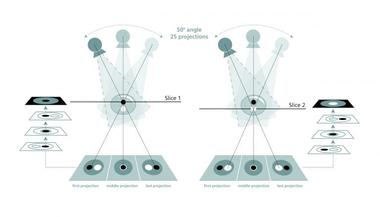 Empire Tomosintesis High Definition – INTEMED